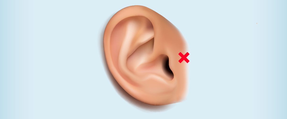 How to assess pulse points as an RN