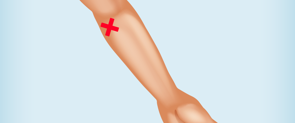 How to assess pulse points as an RN