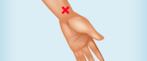 How to assess pulse points as an RN