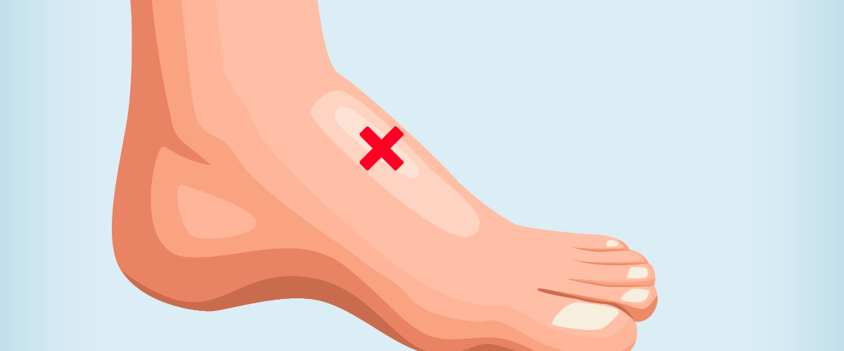 How to assess pulse points as an RN