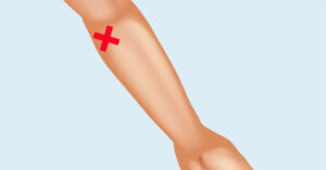 How to check pulse points in an RN nursing assessment?