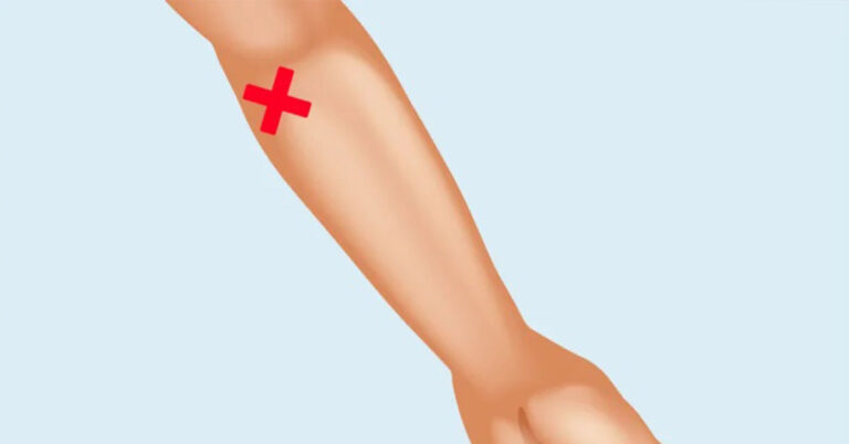 How to check pulse points in an RN nursing assessment?