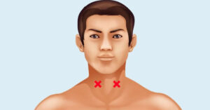 How to check pulse points in an RN nursing assessment?