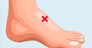 How to check pulse points in an RN nursing assessment?