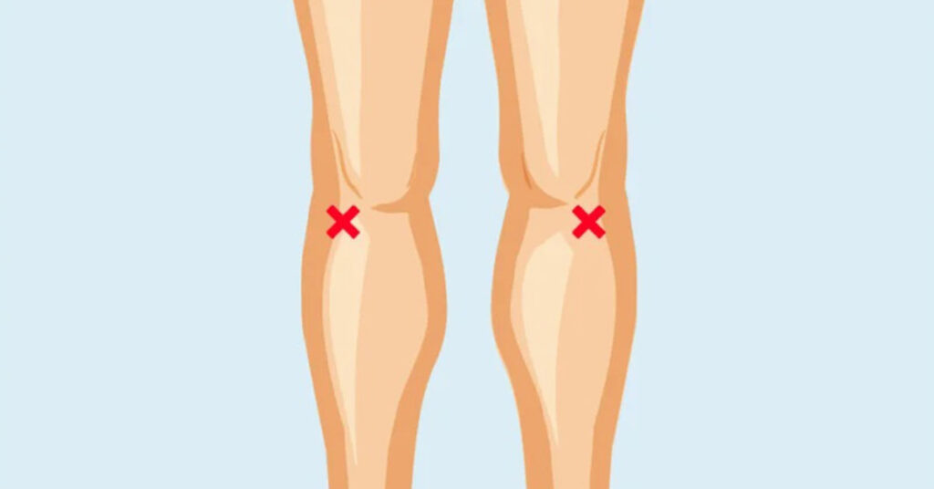 How to check pulse points in an RN nursing assessment?