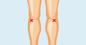 How to check pulse points in an RN nursing assessment?