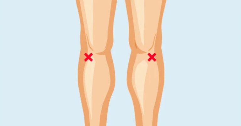 How to check pulse points in an RN nursing assessment?