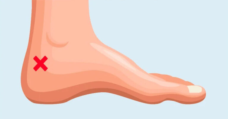 How to check pulse points in an RN nursing assessment?