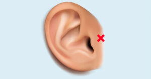 How to check pulse points in an RN nursing assessment?