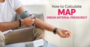 Quick and easy formulas to calculate Mean Arterial Pressure