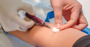 How to draw blood professionally?