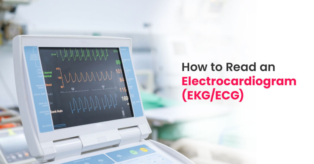 How to read an EKG/ECG?
