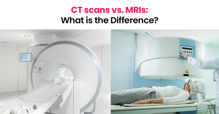 CT scan vs MRI: Which one to Choose?