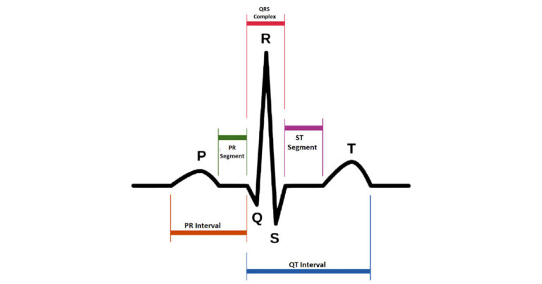 How To Read An EKG/ECG Wave? PQRST Wave Explained