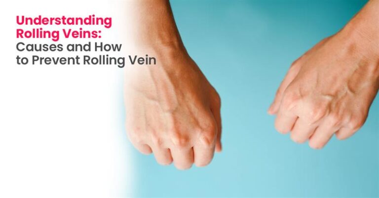 How to Prevent Rolling Veins