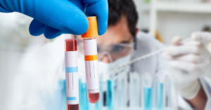 MPV and MCV: A Deep Dive into Blood Test Results